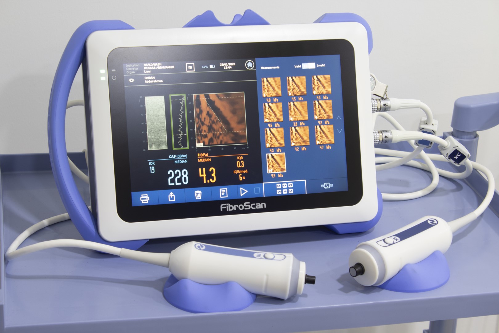 Fibroscan - Dr Douglas Samuel